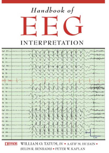 دانلود کتاب Handbook of EEG Interpretation